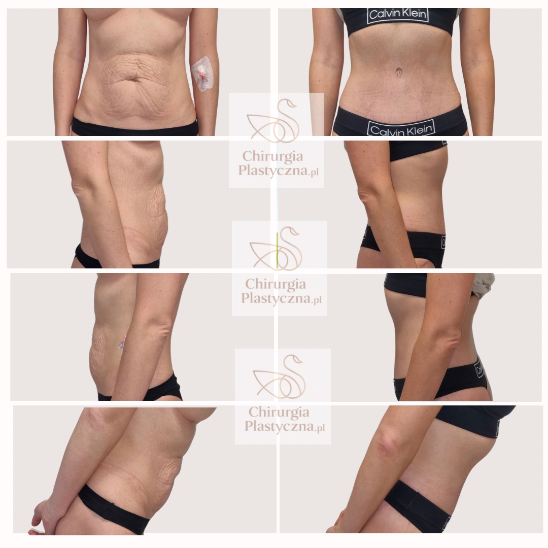 Chirurgia plastyczna